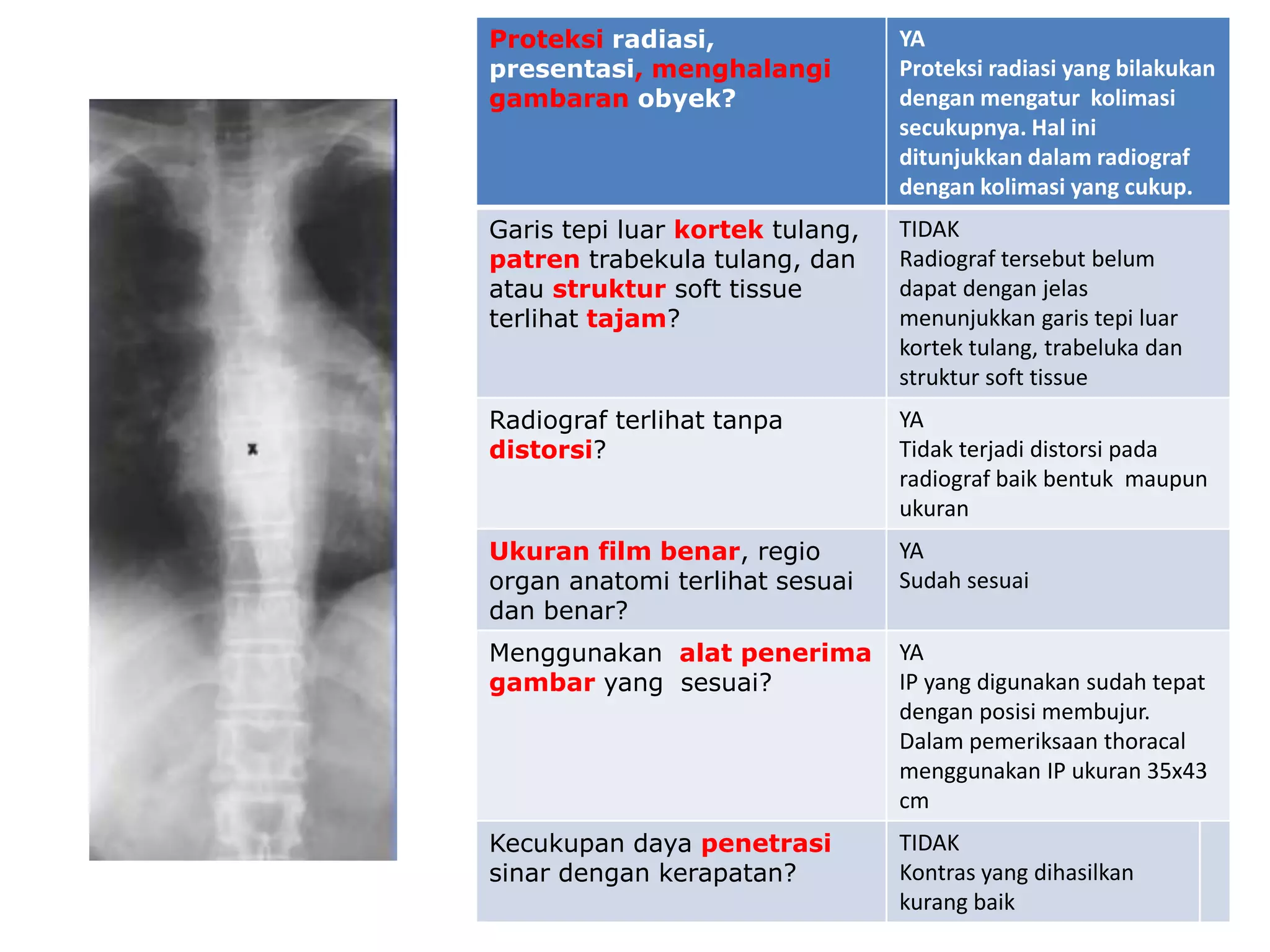 ppt kritisi dan evaluasi radiograf Cervical dan thoracal | PPTX