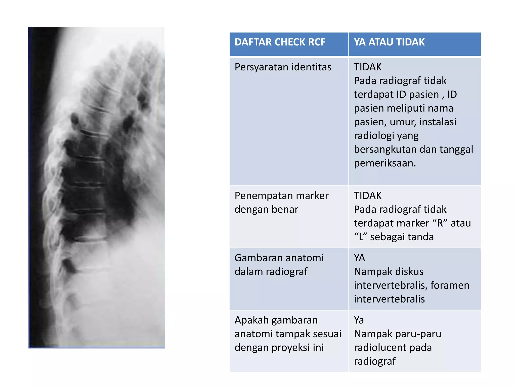 ppt kritisi dan evaluasi radiograf Cervical dan thoracal | PPTX