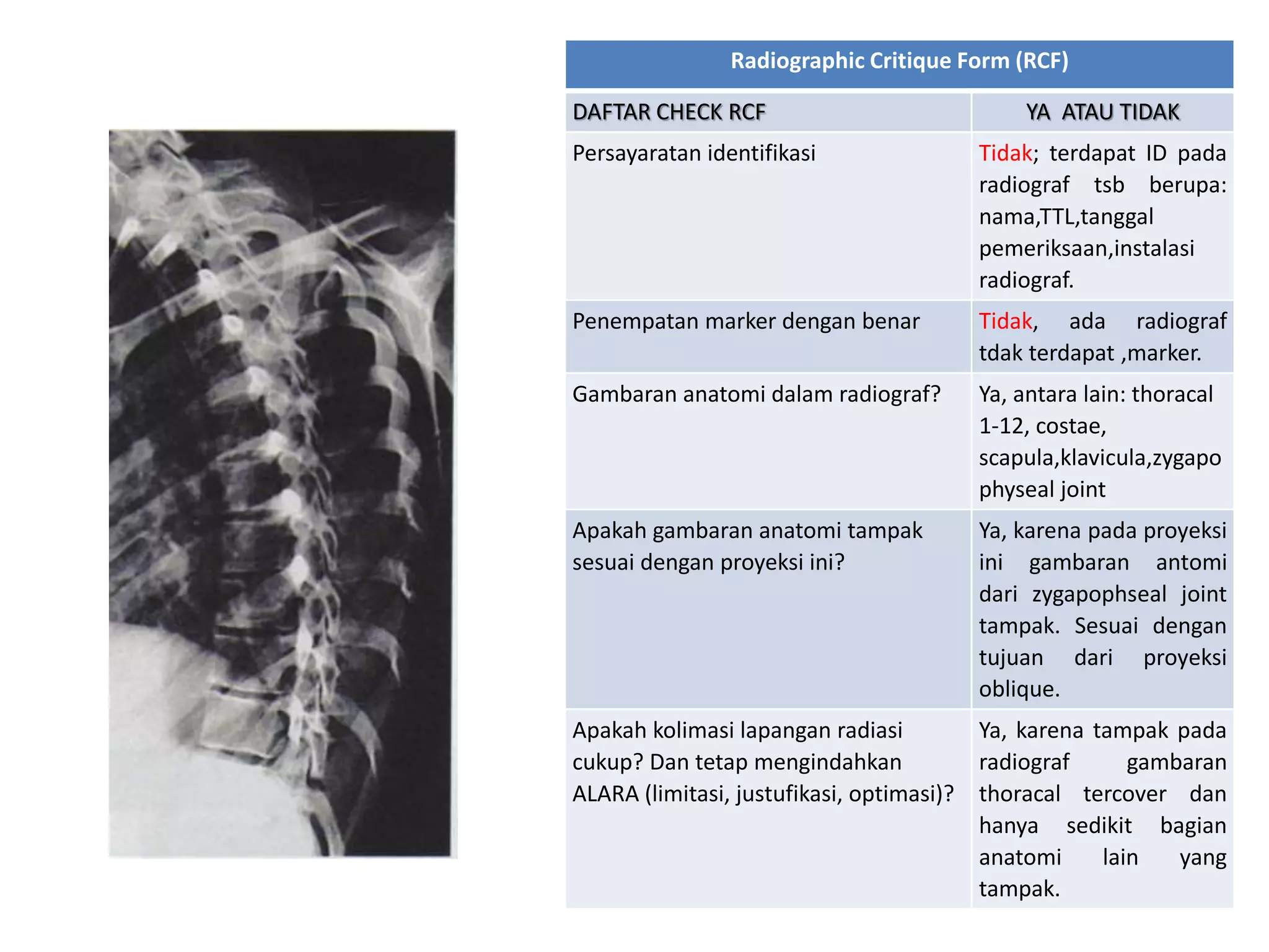 ppt kritisi dan evaluasi radiograf Cervical dan thoracal | PPTX