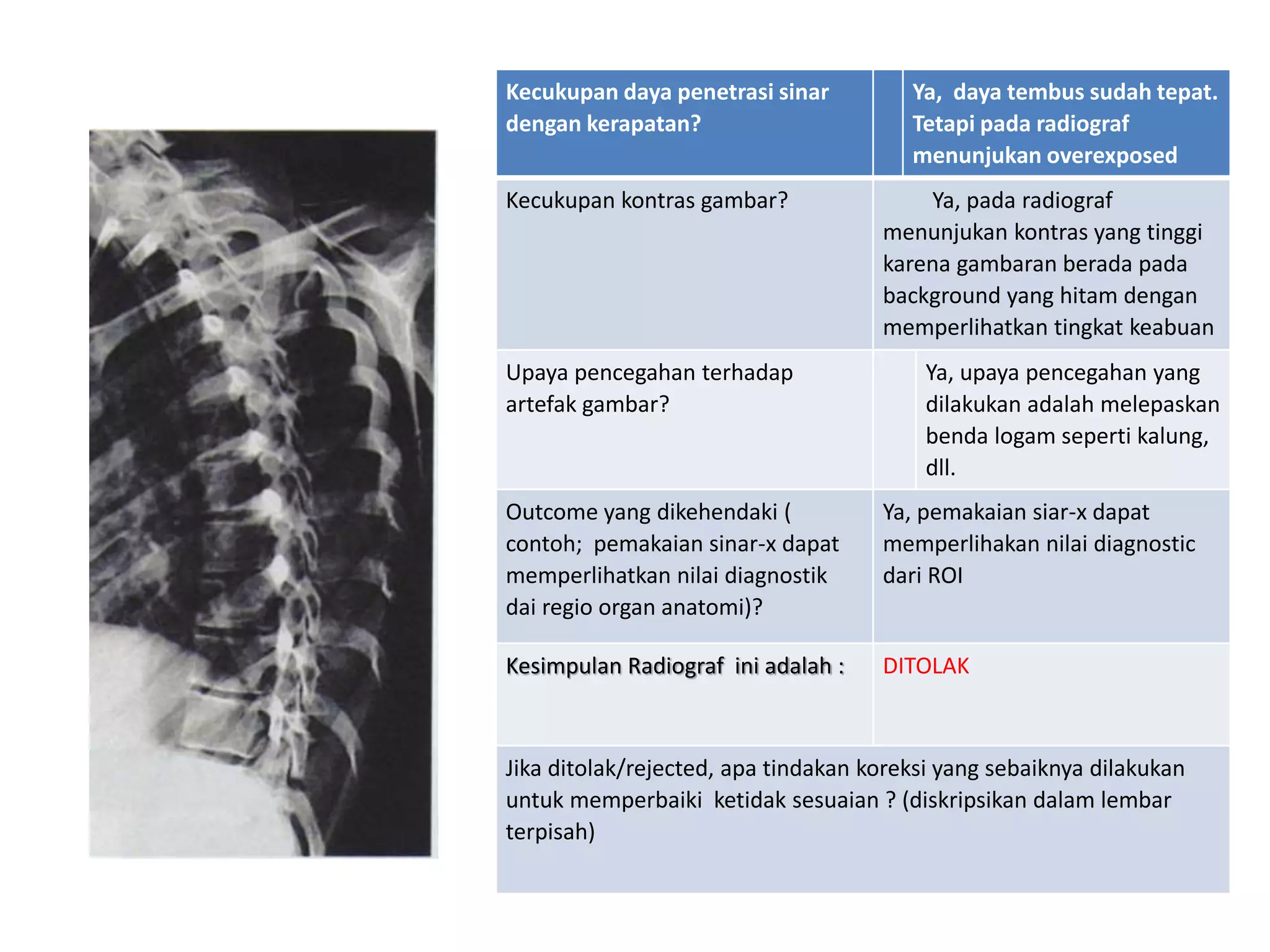 ppt kritisi dan evaluasi radiograf Cervical dan thoracal | PPTX