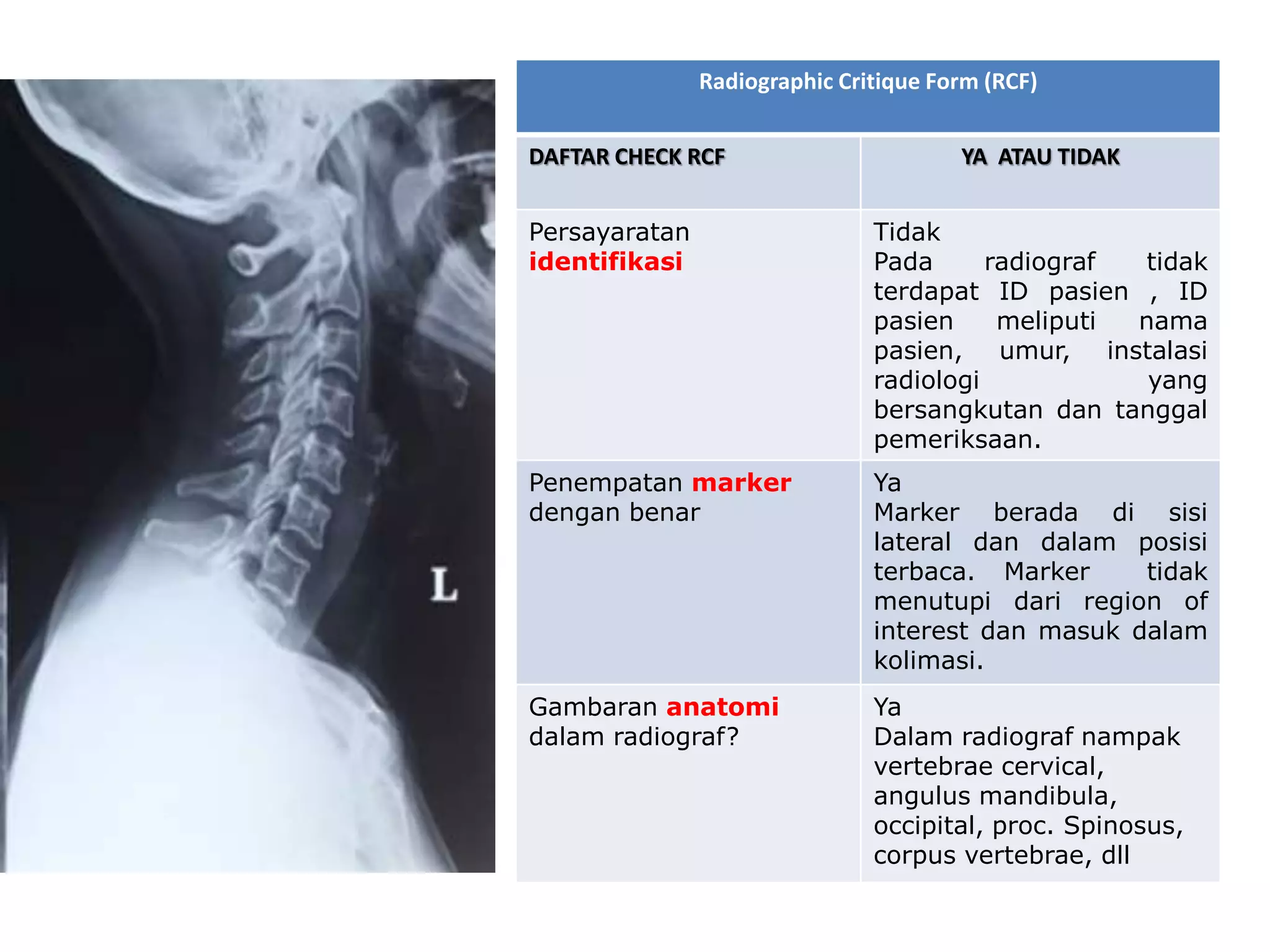 ppt kritisi dan evaluasi radiograf Cervical dan thoracal | PPTX