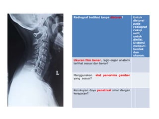 ppt kritisi dan evaluasi radiograf Cervical dan thoracal | PPTX