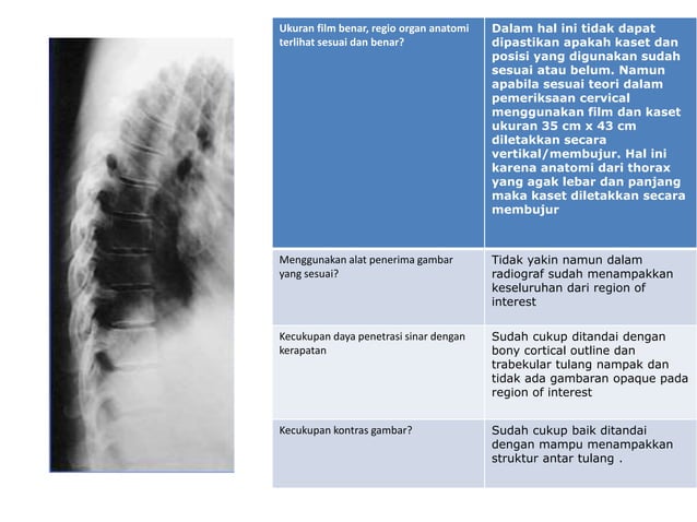 ppt kritisi dan evaluasi radiograf Cervical dan thoracal | PPTX
