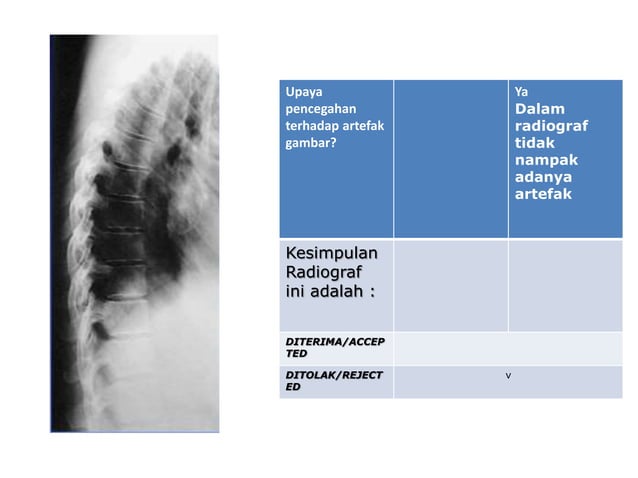 ppt kritisi dan evaluasi radiograf Cervical dan thoracal | PPTX