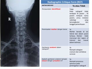 ppt kritisi dan evaluasi radiograf Cervical dan thoracal | PPTX