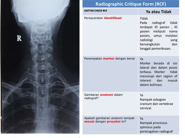 ppt kritisi dan evaluasi radiograf Cervical dan thoracal | PPTX