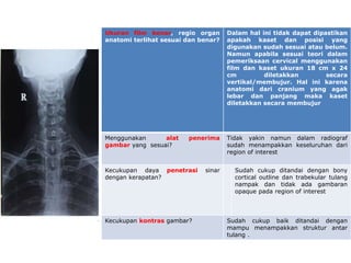 ppt kritisi dan evaluasi radiograf Cervical dan thoracal | PPTX
