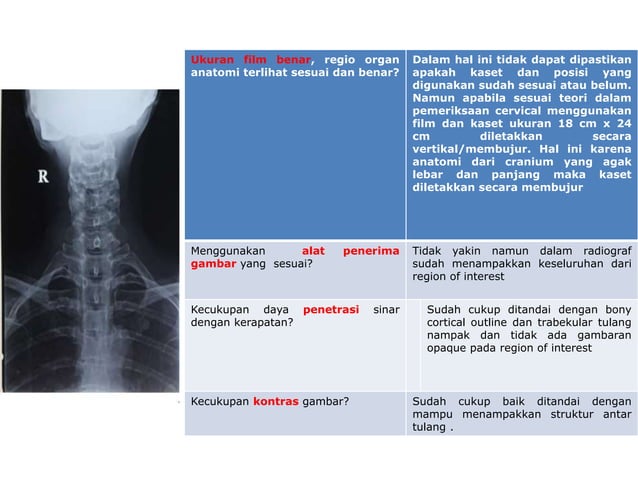 ppt kritisi dan evaluasi radiograf Cervical dan thoracal | PPTX