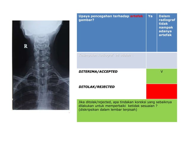 ppt kritisi dan evaluasi radiograf Cervical dan thoracal | PPTX