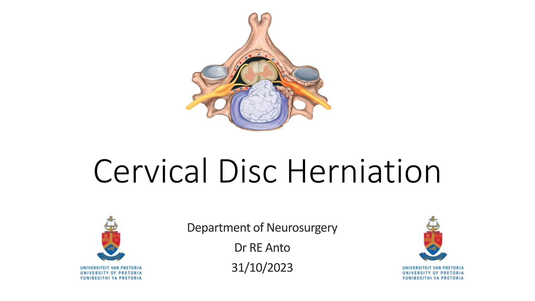 Overview of Cervical Disc Herniation.pptx