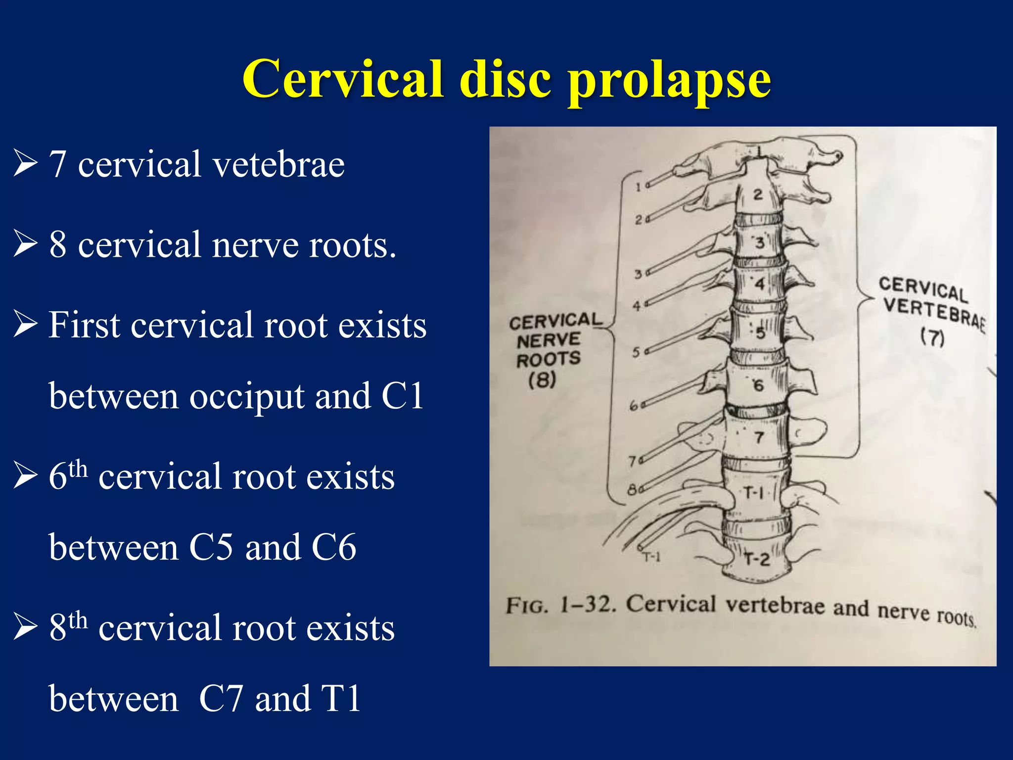 Cervical disc prolapse | PPTX