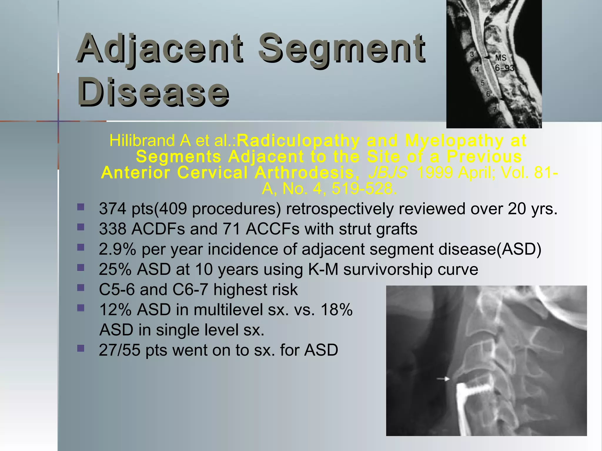 Cervical Disc Replacement | PPT | Physical Therapy | Wellness