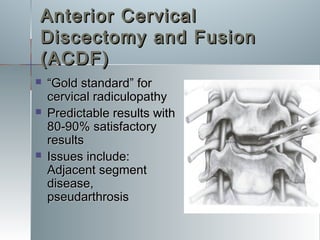 Cervical Disc Replacement Surgery | PPT