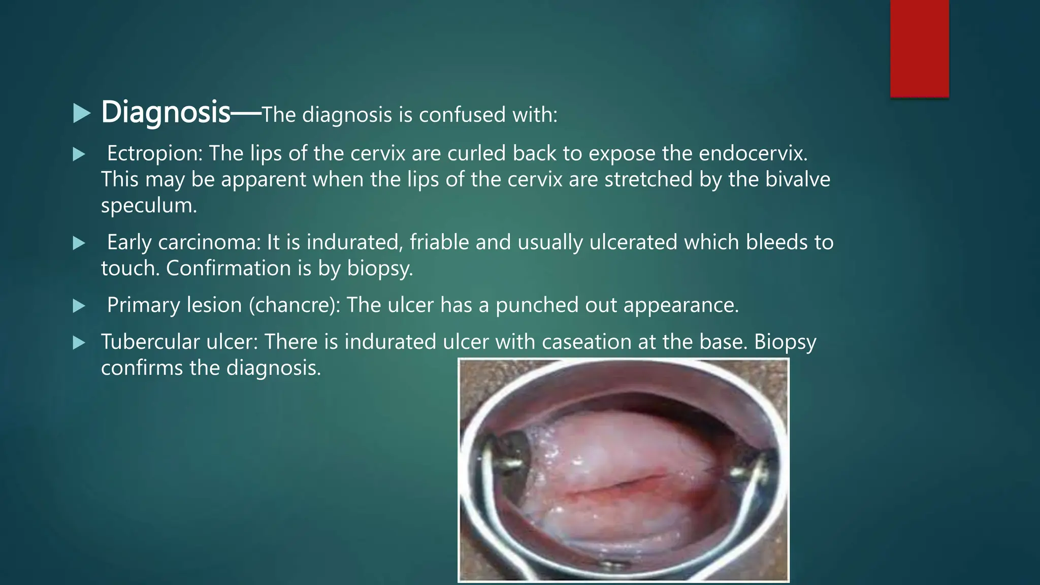 Cervical Ectopy or cervical erosion.pptx