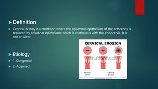 Cervical Ectopy or cervical erosion.pptx