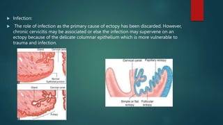 Cervical Ectopy or cervical erosion.pptx