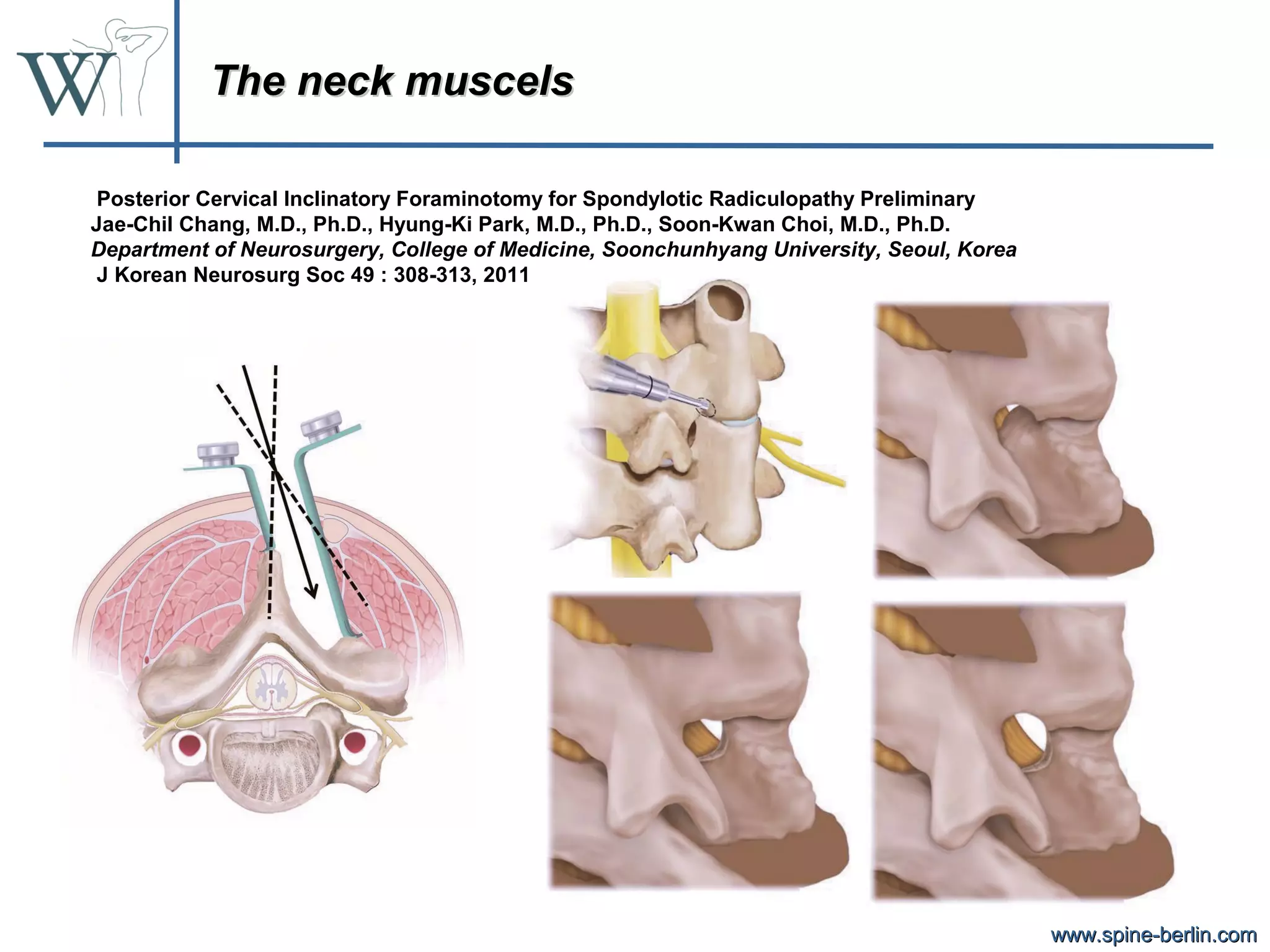 Cervical endoscopy | PPT