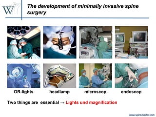 Cervical endoscopy | PPT
