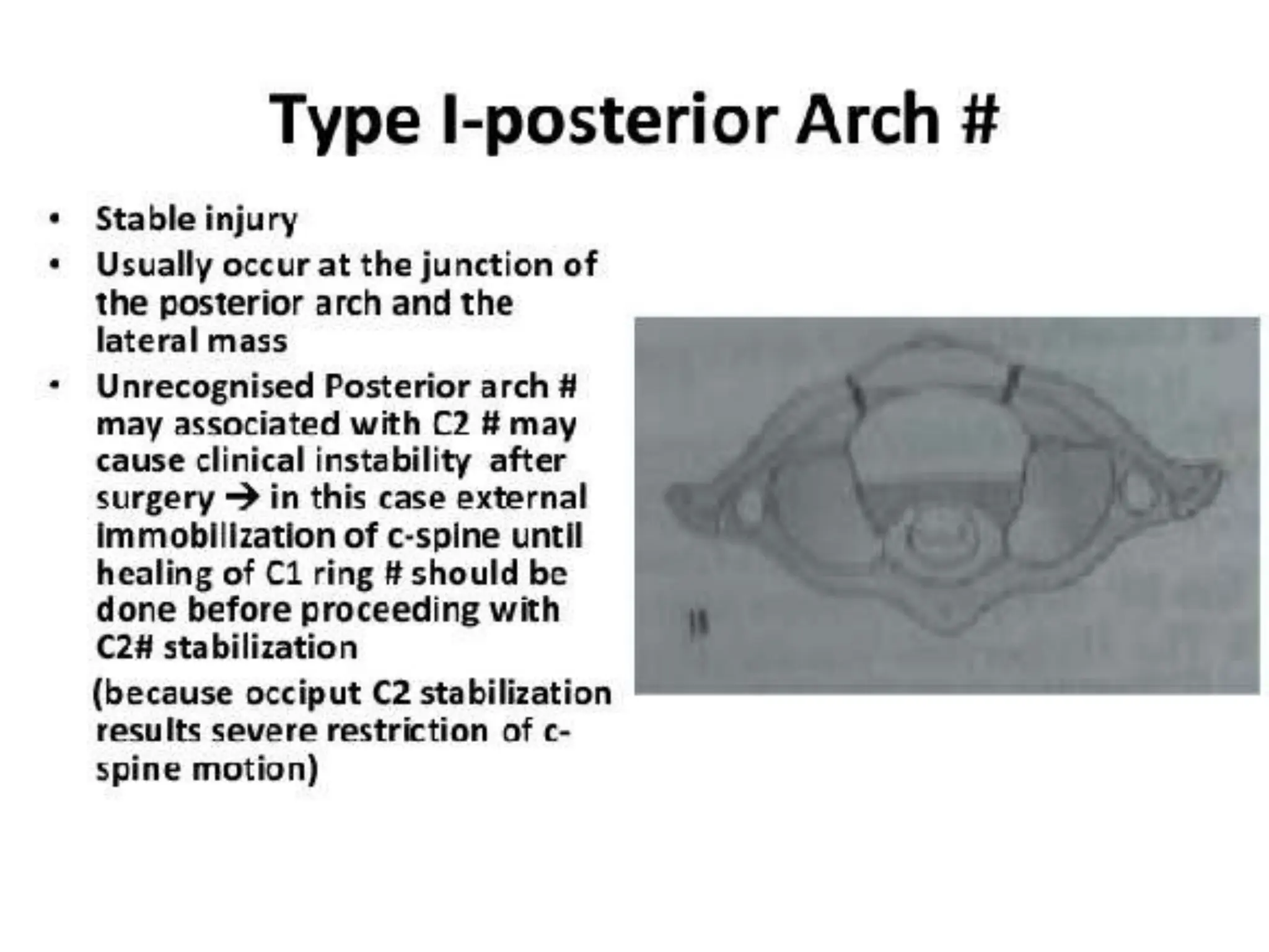 Cervical fracture and injuries Presentation | PPT