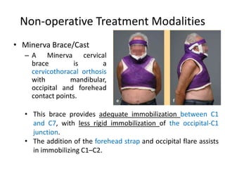 Cervical fractures | PPTX