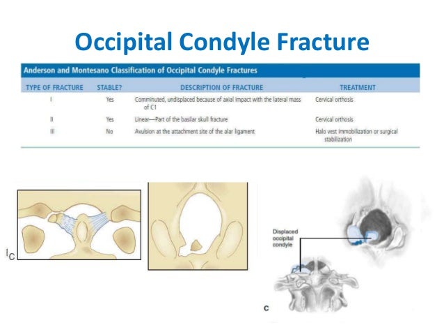 Cervical fractures