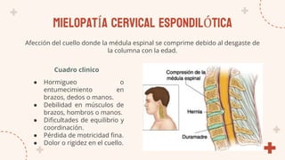 Cervicalgia (Sindrome de dolor cervical).pptx
