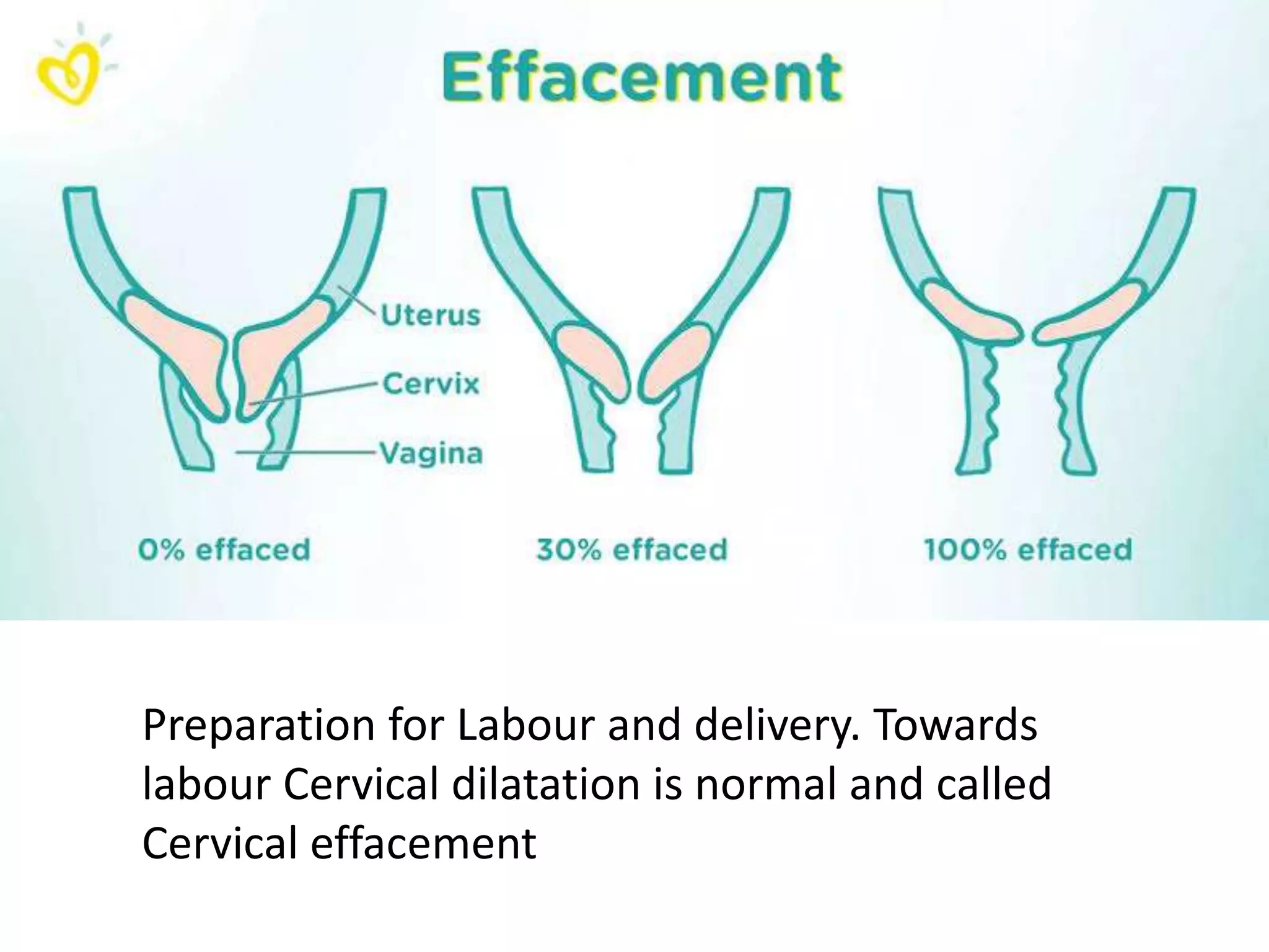CERVICAL INCOMP-WPS Office.pptx