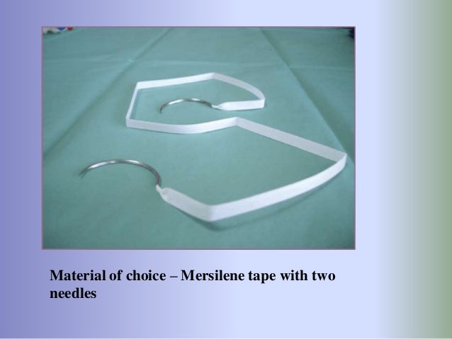 Cervical incompetence