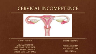 Cervical incompetence | PPT