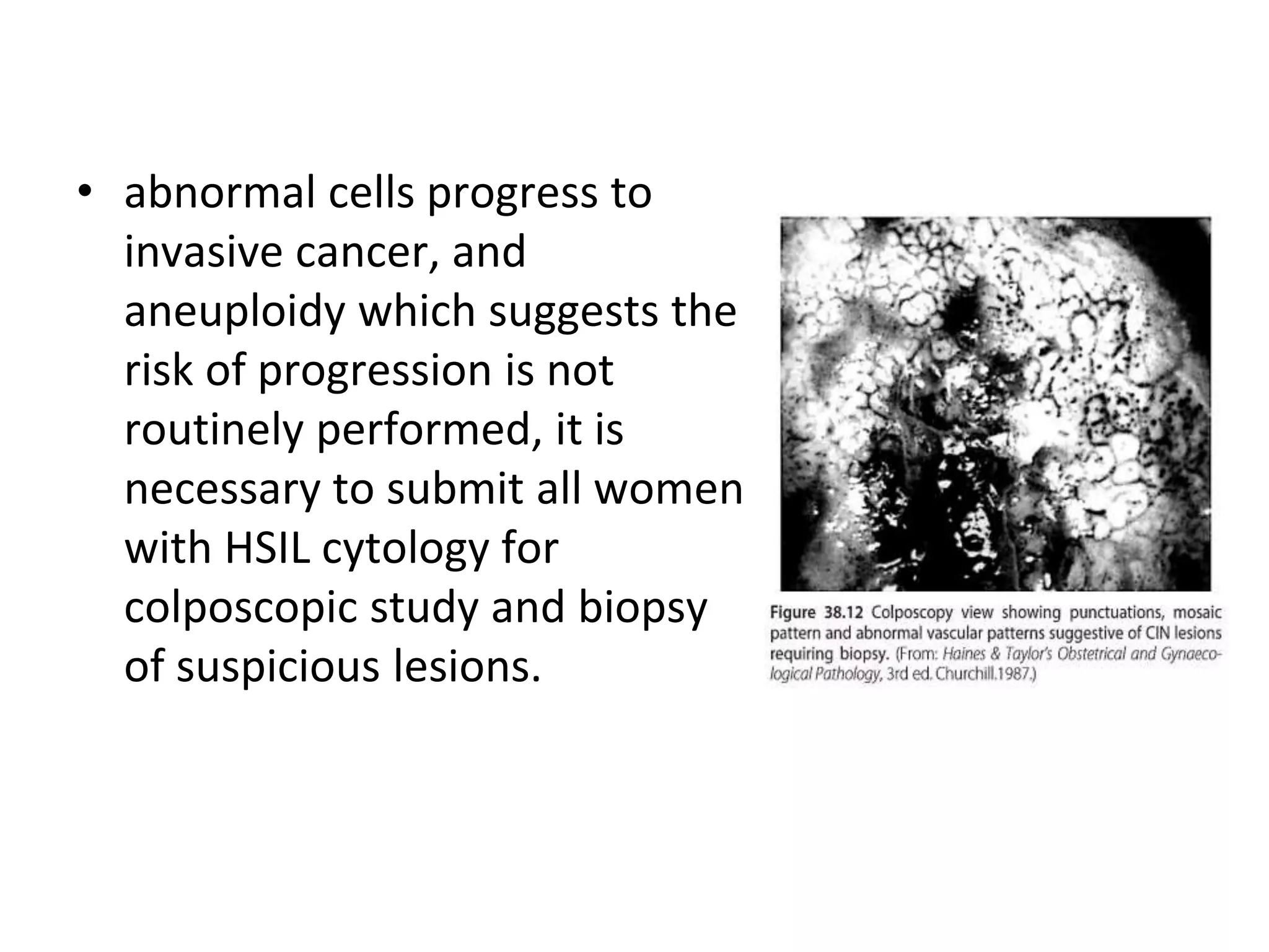 Cervical intraepithelial neoplasia, carcinoma of cervix | PPT