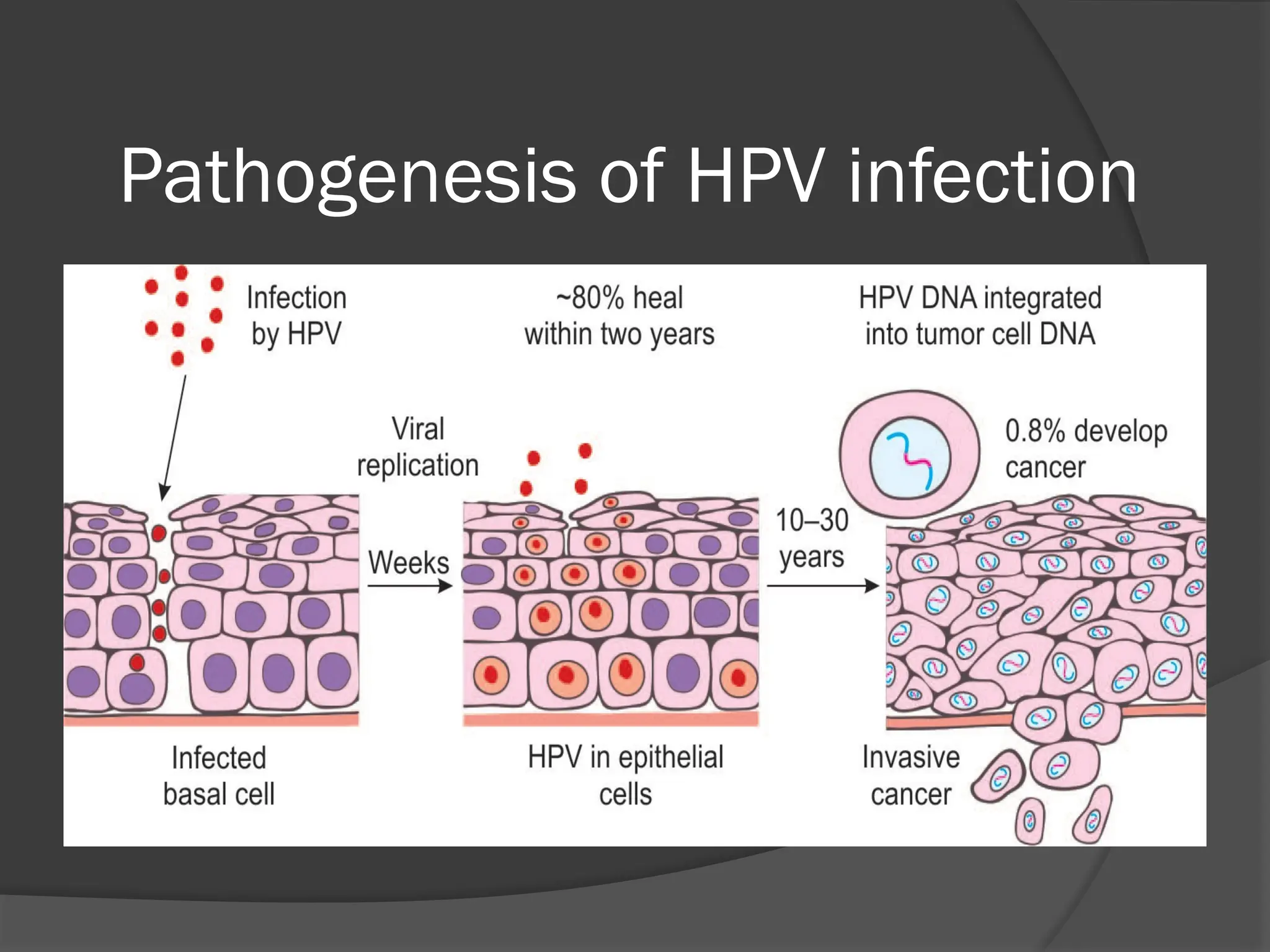 CERVICAL INTRAEPITHELIAL NEOPLASIA (CIN)0001.pptx