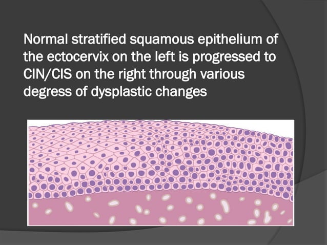 CERVICAL INTRAEPITHELIAL NEOPLASIA (CIN)0001.pptx