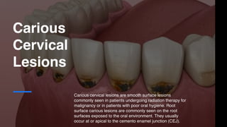 Cervical Lesionssssssssssssssssssssssssss | PDF