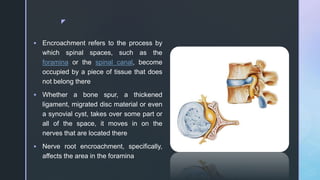 Cervical & lumbar traction | PPTX