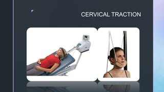 Cervical & lumbar traction | PPT