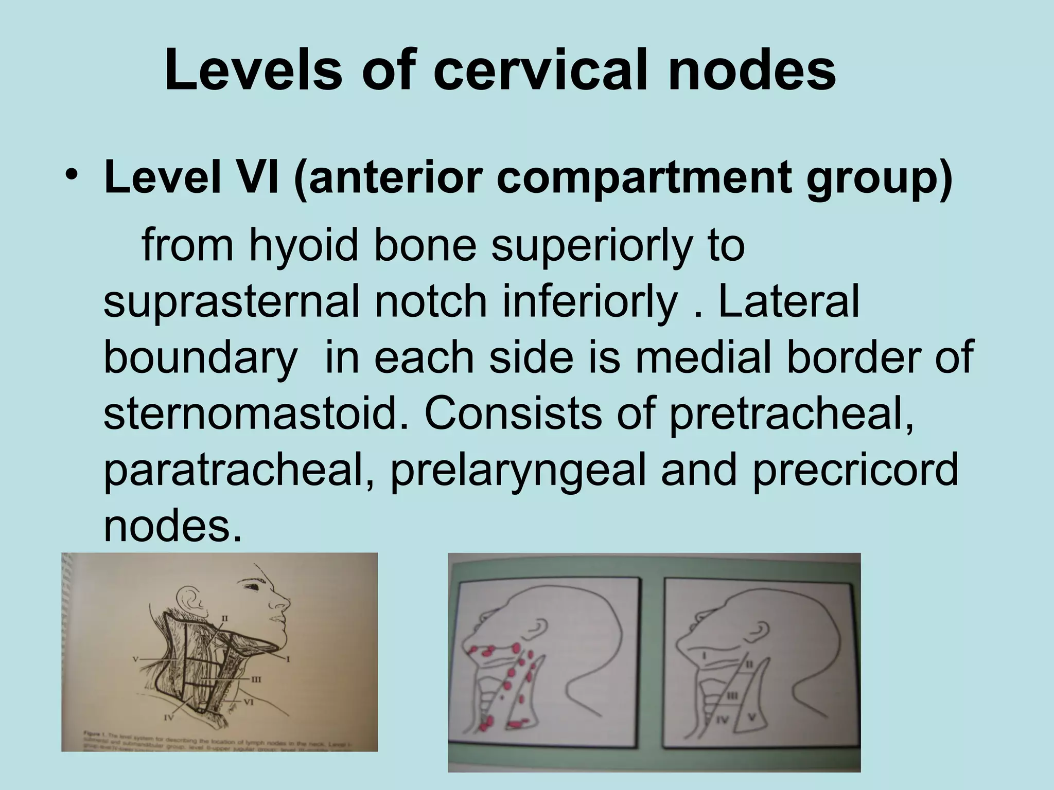 Cervical lymphadenitis | PPT