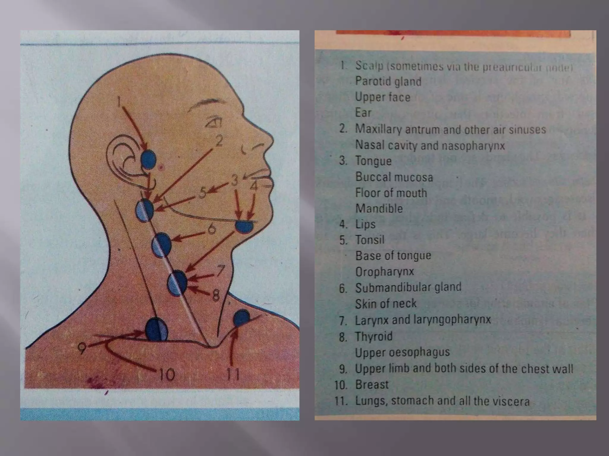 Cervical lymphadenopathy | PPTX