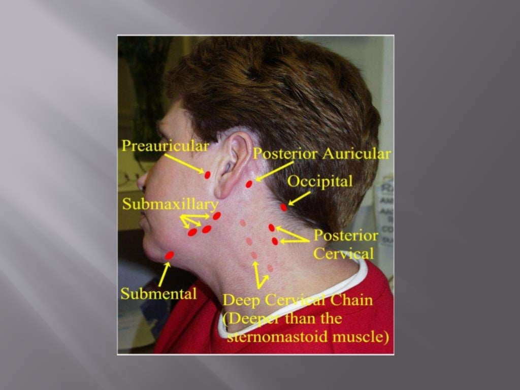 Swollen Posterior Cervical Lymph Nodes Causes Diagnos