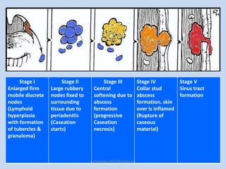 Cervical lymph adenopathy | PPTX