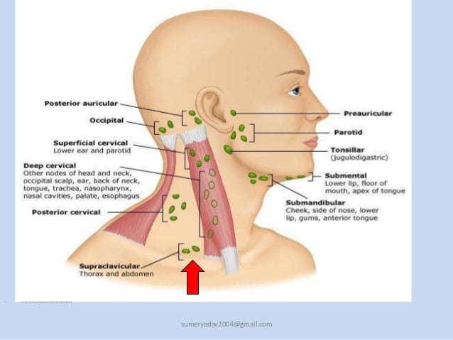 Cervical Lymph Adenopathy