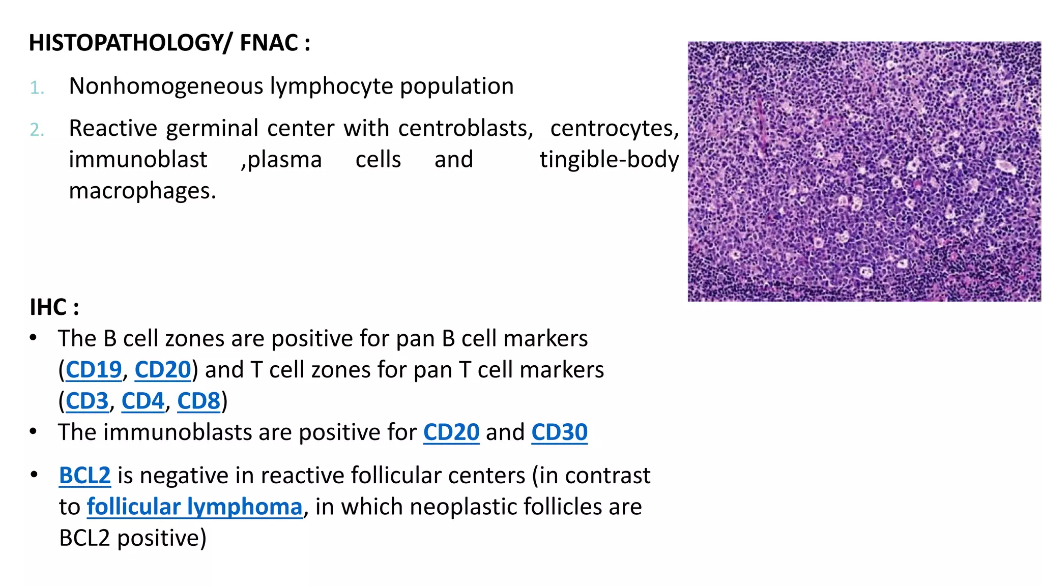 Cervical lymphadenopathy | PPTX