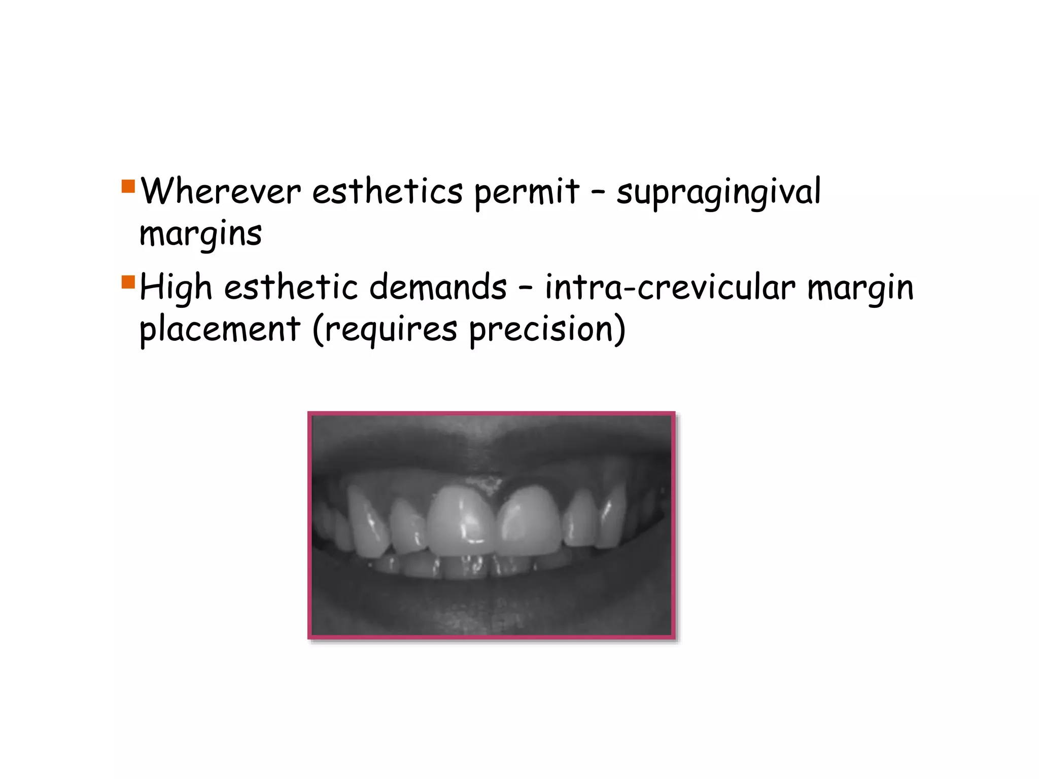 Cervical margin design | PPTX