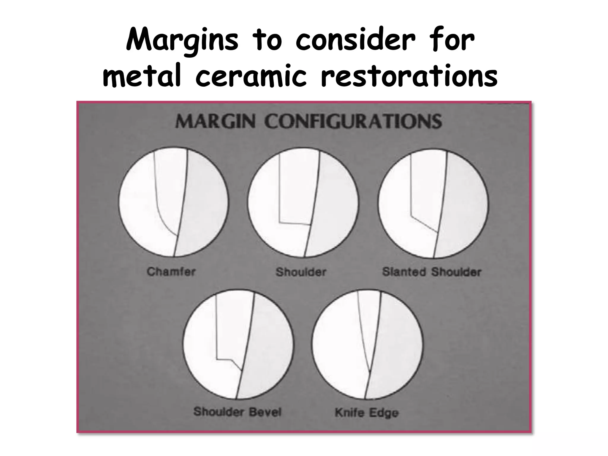 Cervical margin design | PPTX