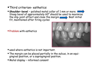 Cervical margin design | PPTX