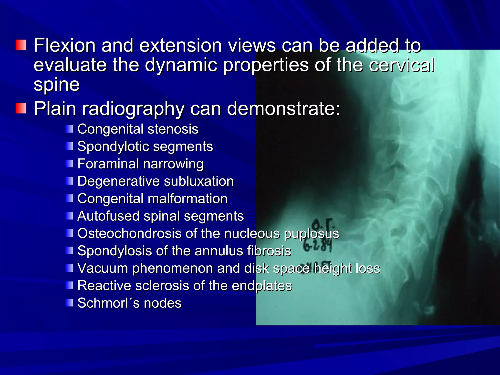 Cervical Myelopathy 2016 | PPT