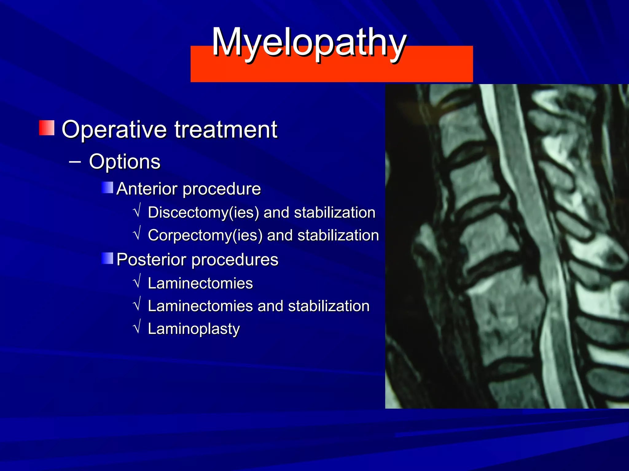 Cervical Myelopathy 2016 | PPT
