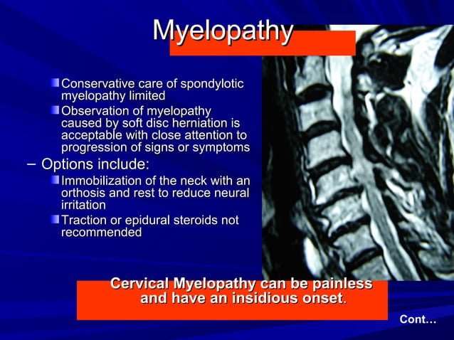 Cervical Myelopathy 2016 | PPT
