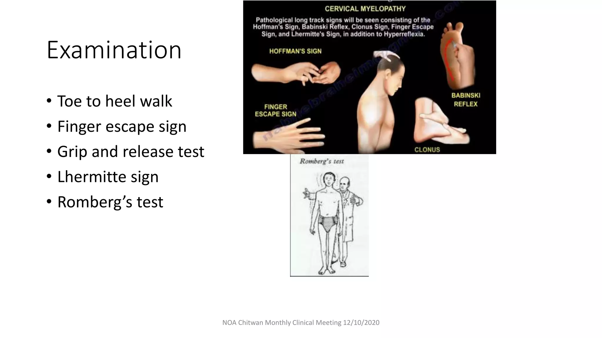 Cervical myelopathy | PPTX