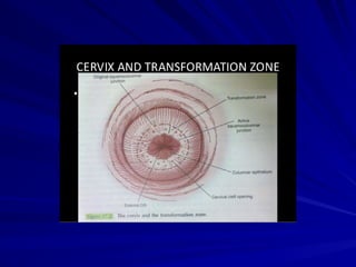 Cervical neoplasia power point presentation | PPT
