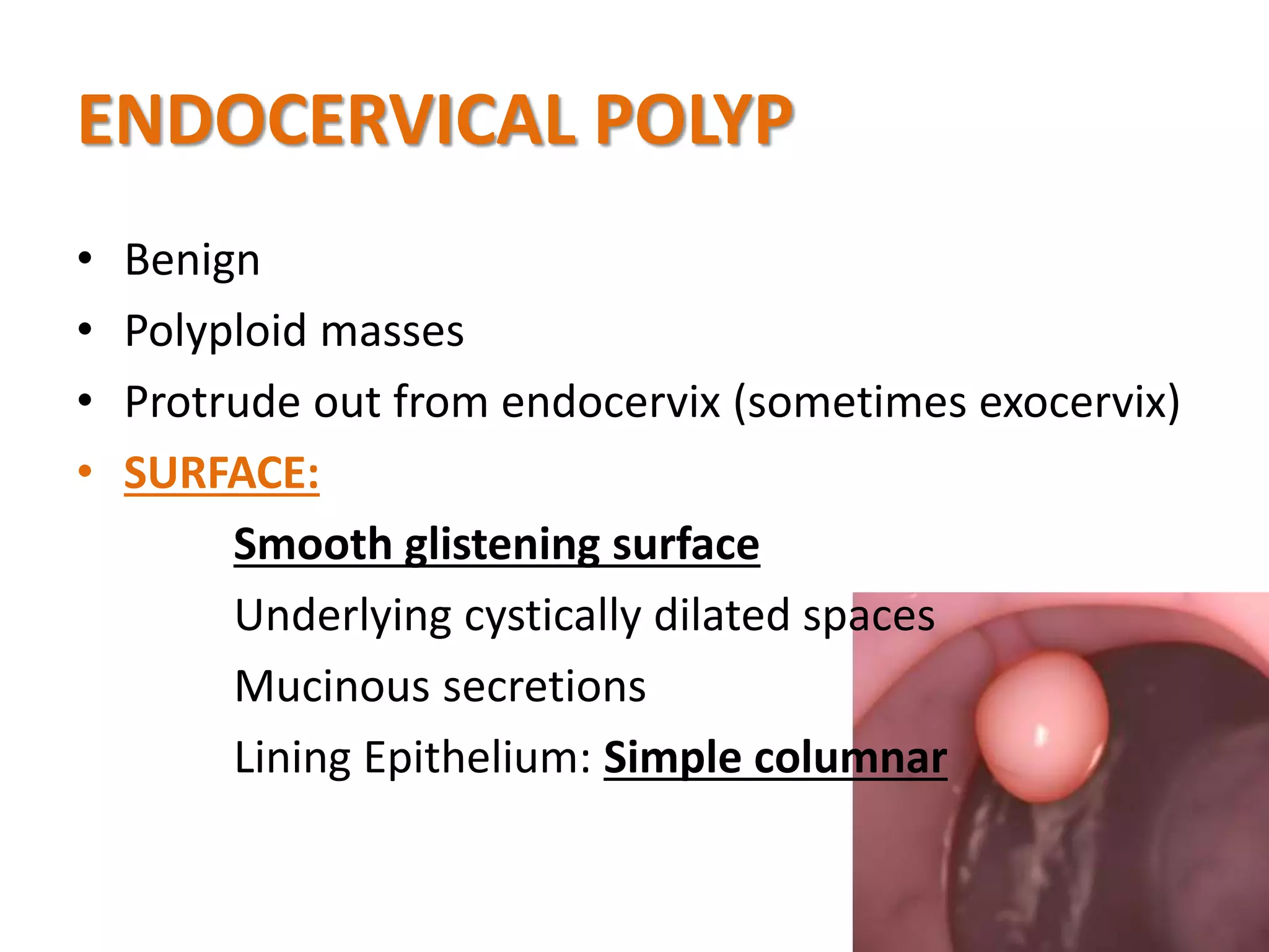 Cervical neoplasms | PPTX